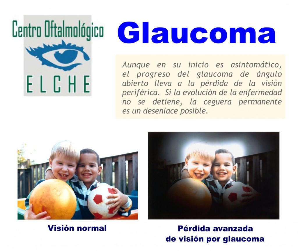 Glaucoma - Centro Oftalmológico de Elche